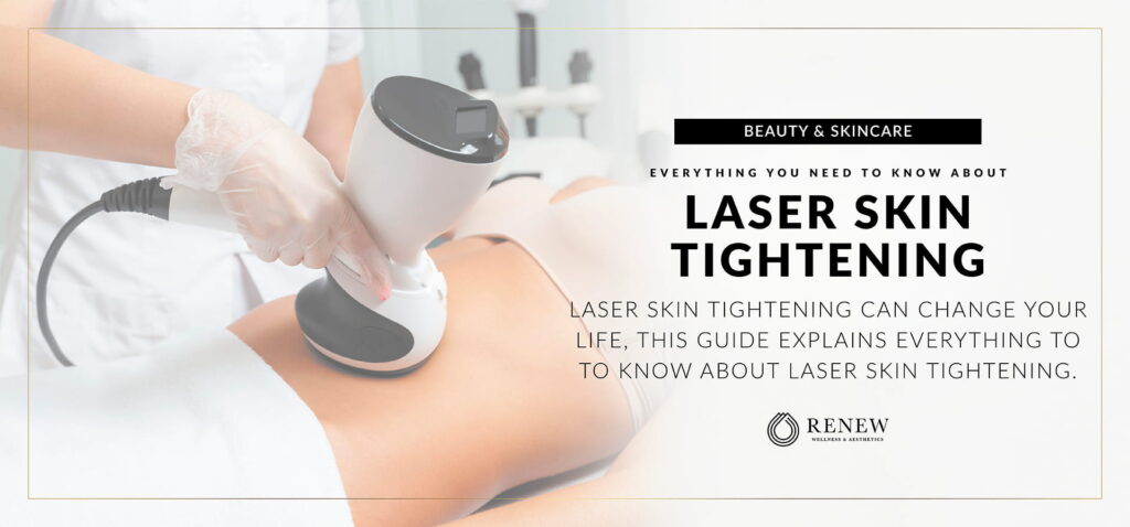 Laser Skin Tightening in OKC - Renew Wellness & Aesthetics